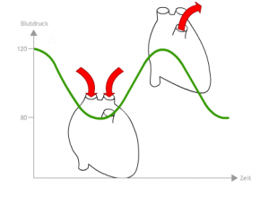 Was ist Blutdruck? Was ist Bluthochdruck (Hypertonie)? – blutdruck ...